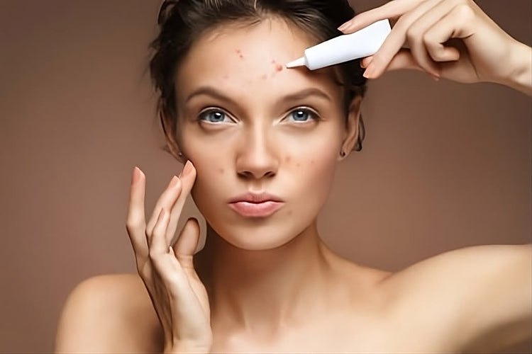 The Best Way to Get Rid of a Blind Pimple – Skin Spa New York