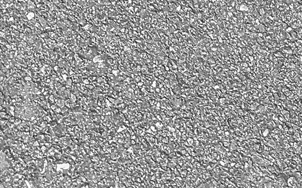 Microdermabrasion | Professional Skin Exfoliation | Skin Spa New York